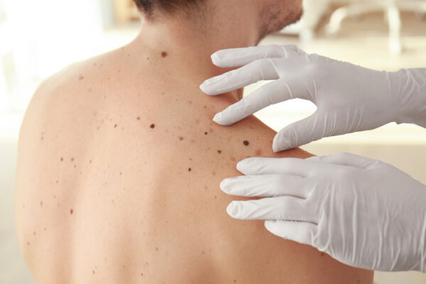 Medical Dermatology - Southern Illinois Dermatology